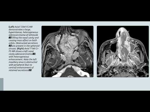 Head and neck radiology diagnostic imaging series images only(5)