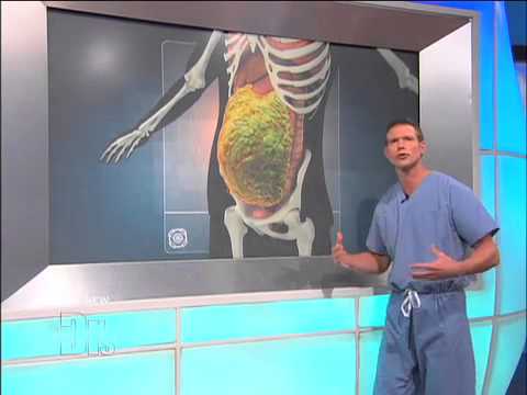 Fast Food s Effect on the Body Medical Course