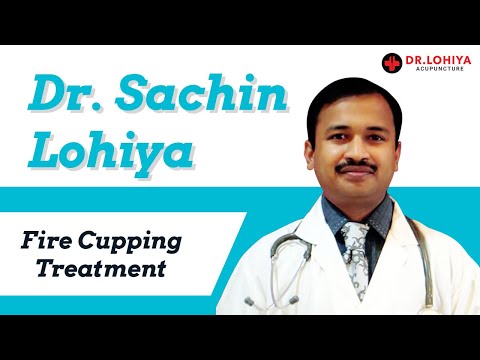 Treatment of Fire Cupping | Acupuncture | Dr. Lohiya – Health