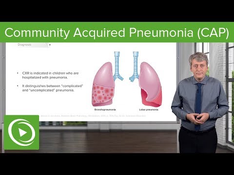 Community Acquired Pneumonia (CAP) – Pediatrics | Lecturio