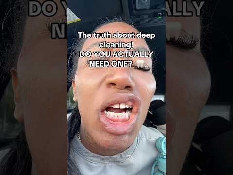 The Truth About DEEP Teeth Cleanings! 😭🦷