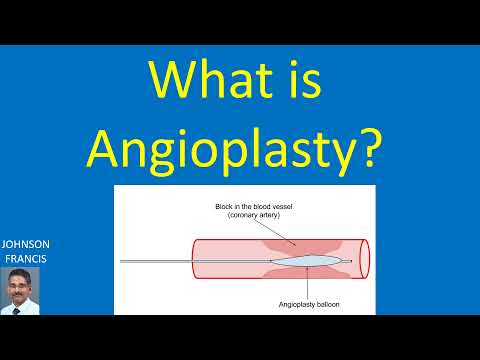 What is Angioplasty?