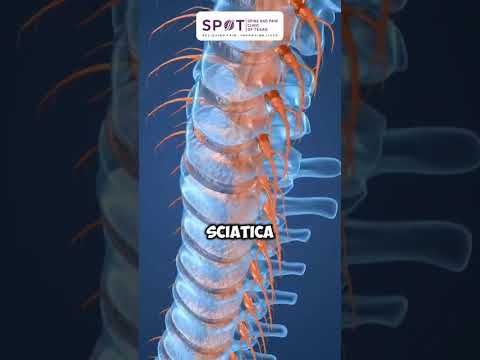 Back Pain Management in Plano