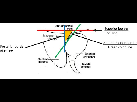 Suprameatal Triangle