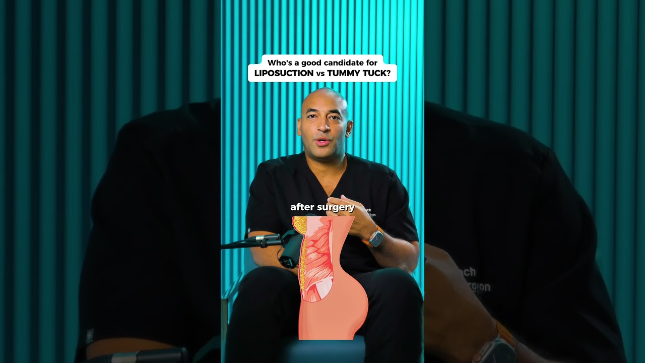 Liposuction vs Tummy Tuck