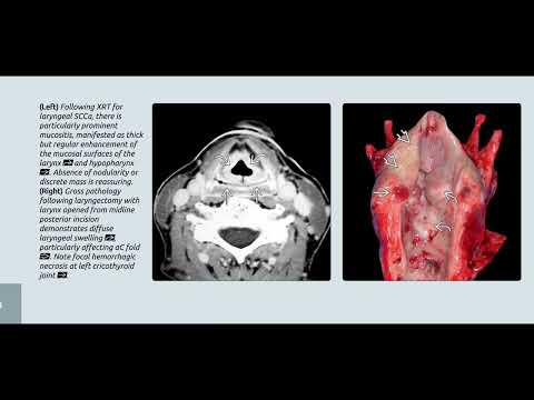 Head and neck radiology diagnostic imaging series images only(3)