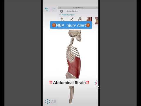 Lebron James Abdominal Strain Injury #shorts