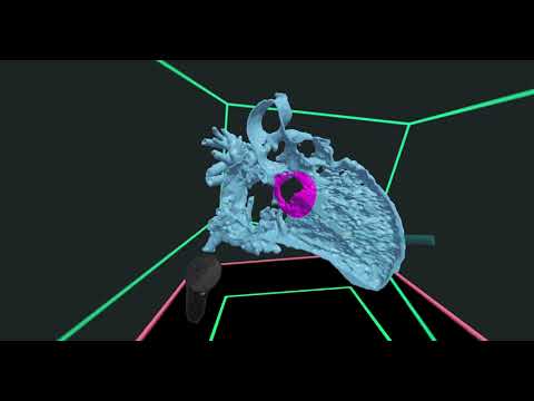 Elucis 4D DORV Case