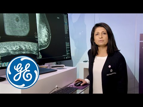 What's new with GE Healthcare - Invenia ABUS 2.0 | GE Healthcare