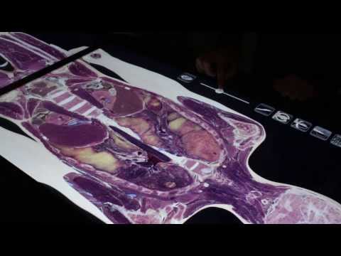 Anatomy Teaching at University of Birmingham: Anatomage Table