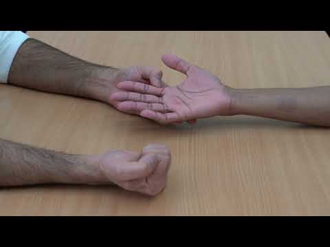 Trigger Finger exam