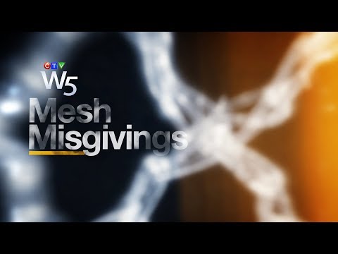 W5: How safe are surgical mesh implants?
