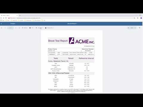 Introducing the JSViewer | ActiveReports