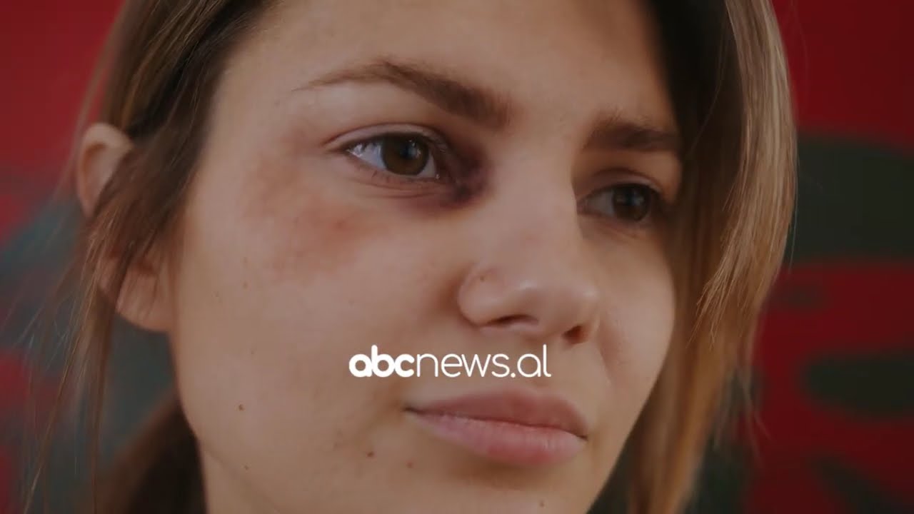 Gra qëndrestare ndaj dhunës/ Heshtja vret, kurajo çon jetë përpara | ABC News Albania