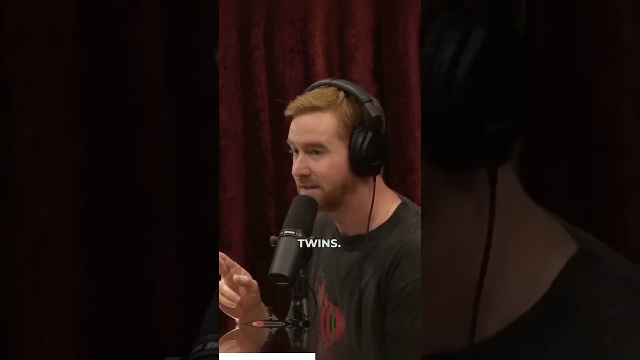 The science behind mirror-image twins is insane... it's just one step away from being conjoined. 🤯