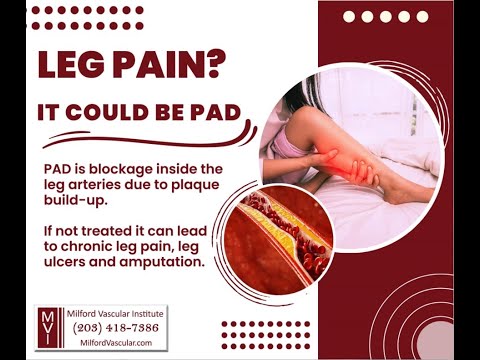 PAD Treatment New Haven CT - What is Peripheral Artery Disease (PAD)?