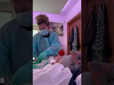 Spinal cord injury SPC #sia #spinalcordinjury #spinalcordinjuryrecovery #carers #spinal