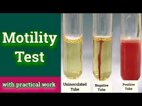 Motility test - Microbiology (Microbial Biochemical test)