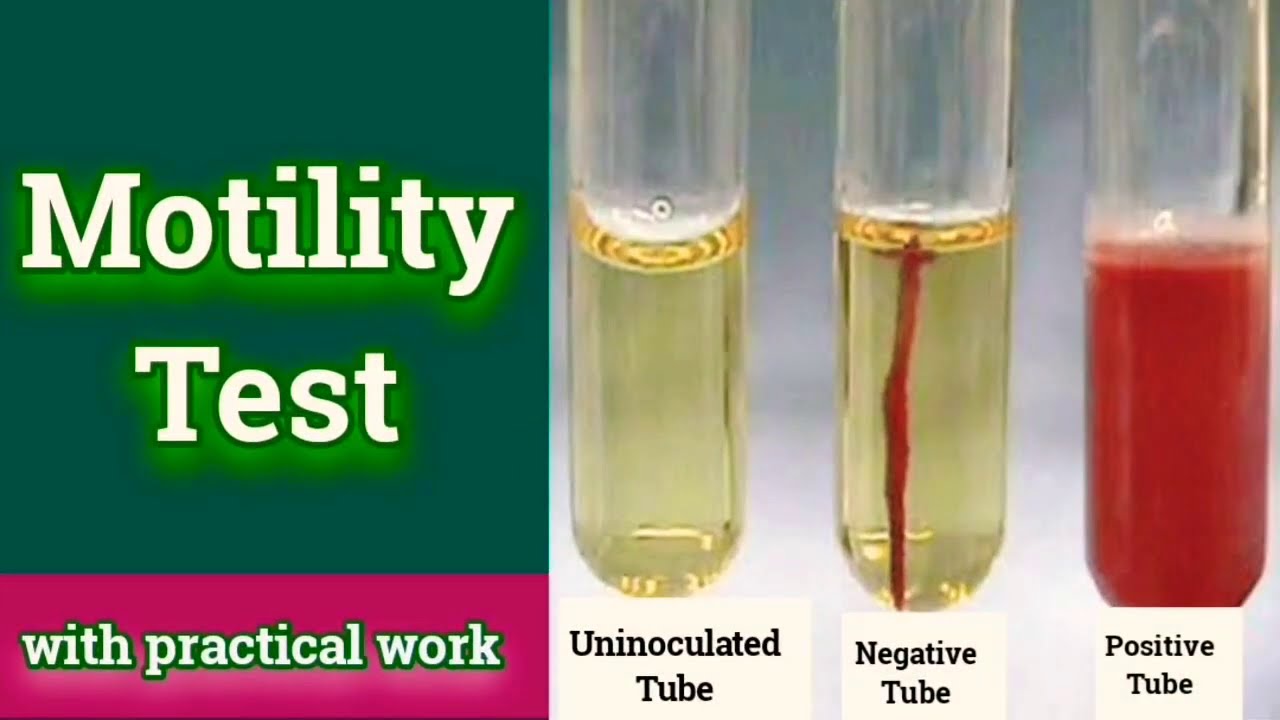 Motility test - Microbiology (Microbial Biochemical test)