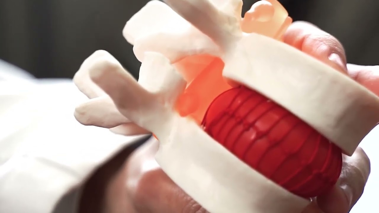 Herniated Disc - Advanced Wellness in Freehold and Marlboro NJ