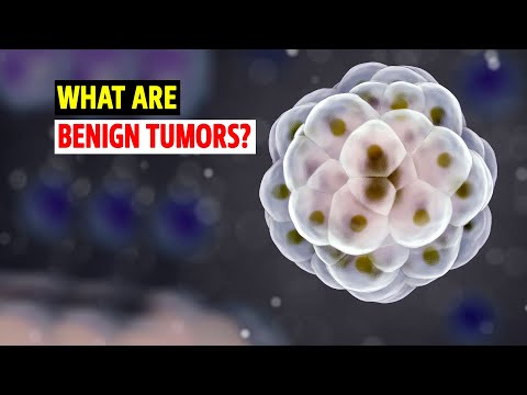 What are Benign tumors
