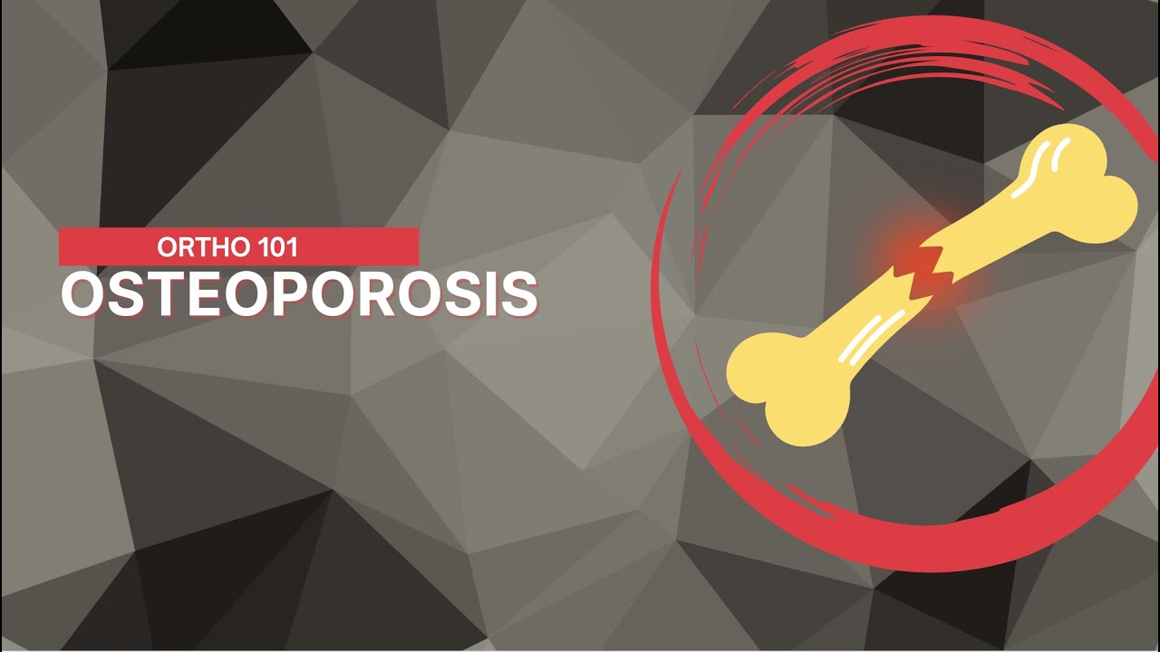 A Guide to Understanding Osteoporosis: Bones Don't Bounce Back | Ortho 101