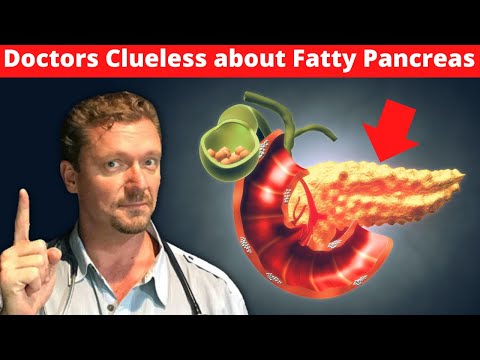 Doctors Clueless about Fatty Pancreas [Worse than Fatty Liver] 2024