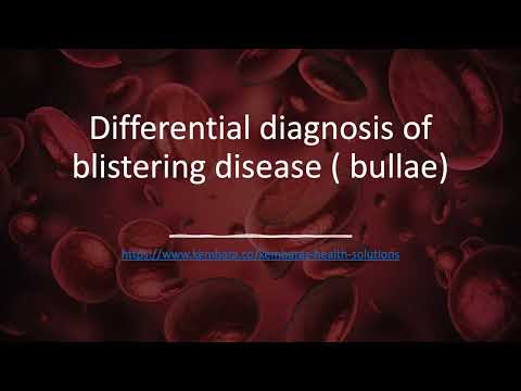 Differential diagnosis of blistering disease bullae