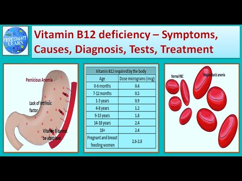 Vitamin B12 deficiency – Symptoms, Causes, Diagnosis, Tests, Treatment