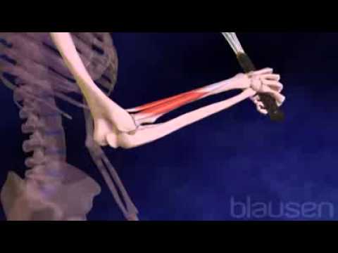 Comment soigner une tendinite a l'avant bras ? La réponse est sur ...