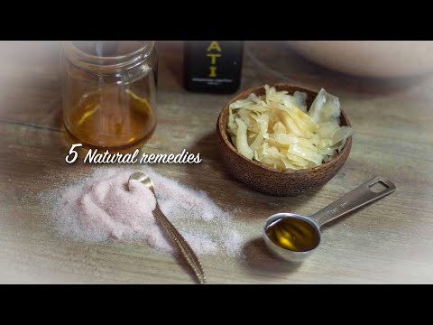 NATURAL POLLEN ALLERGY REMEDIES | How to get rid of hayfever and allergy symptoms