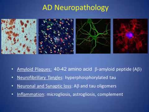 Generation and Use of iPSC derived Microglia to Study Neurodegenerative Diseases