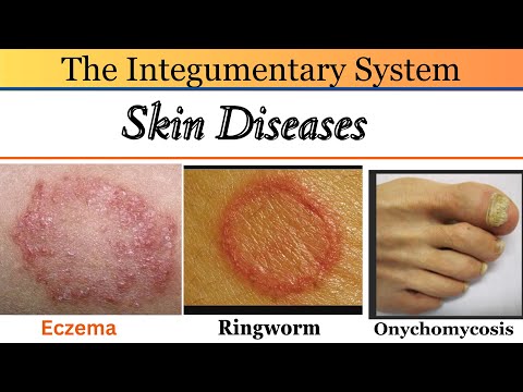 Skin diseases pictures with names | skin disorders and diseases | skin changer |atopic dermatitis ⚡⚡