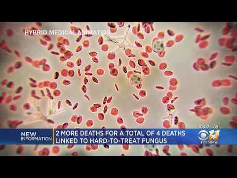 Collin County Says Candida Auris Fungus Responsible For 4 Deaths