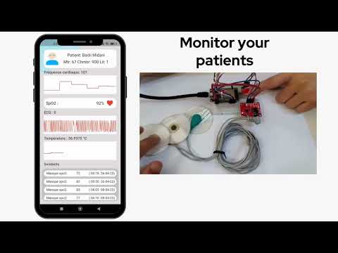 Medical IoT System for Connected Patient Monitoring