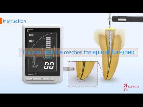 Apex Locators - Dental Apex Locators Latest Price, Manufacturers ...