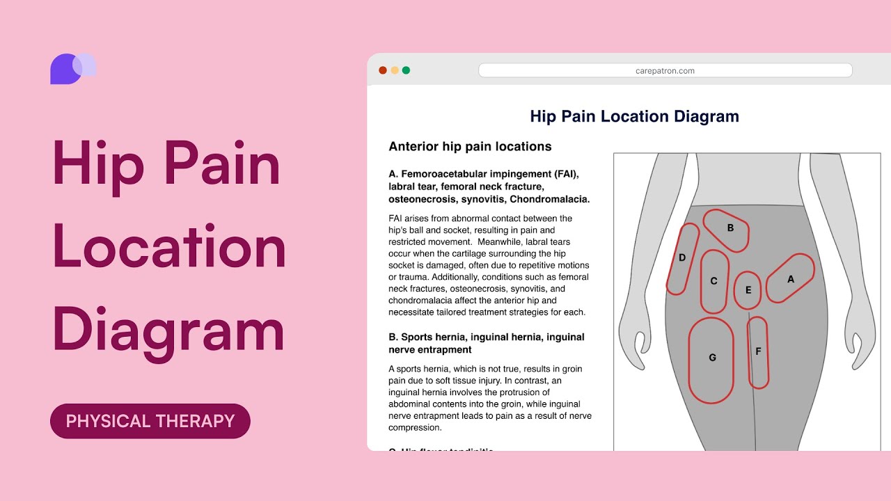 Hip Pain Location Diagram