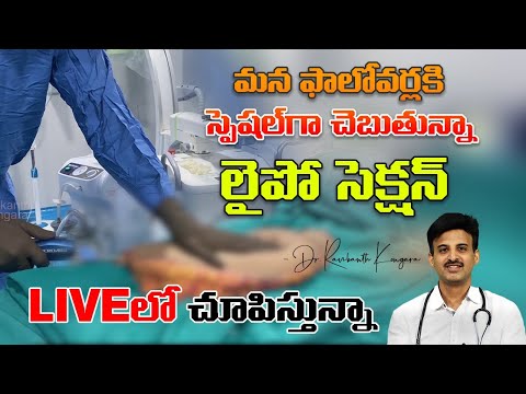 Weight Loss Surgery | Liposuction Operation Demo | Tummy Tuck | Bariatric | Dr. Ravikanth Kongara