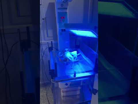 NICU, new born baby care in NICU, phototherapy of new born baby in NICU,CPAP  in NICU, New Born Baby
