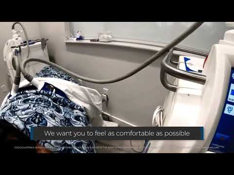 CoolSculpting 2