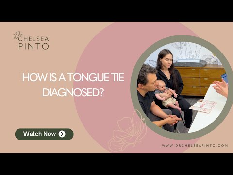 How is a Tongue Tie Diagnosed?