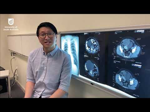 Exploding the myths around x-ray harm
