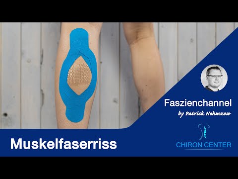 Muskelfaserriss beim Fußball. Das musst Du tun um schnell wieder fit zu werden! Mit Tapinganleitung