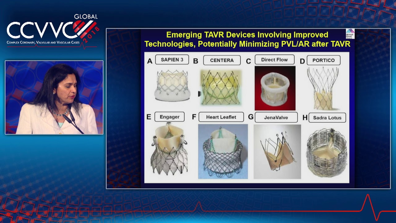 Structural Heart Disease: Transcatheter Interventions