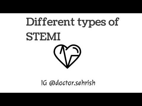 STEMI EKG | STEMI ECG | Different types of STEMI | ST Elevation myocardial infarction