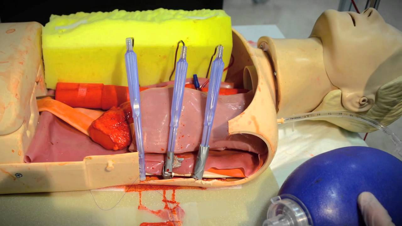 Thoracotomy Simulation
