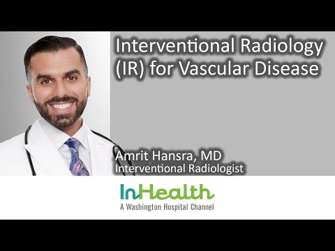 Interventional Radiology (IR) for Vascular Disease