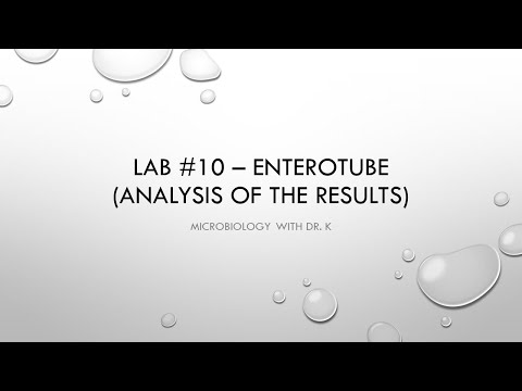 Lab #10 - Analysis of the results