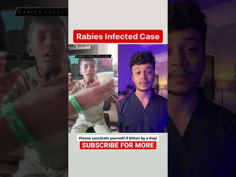 He was bitten by a dog twice😨Rabies Infected Case| Raj Bhosle #shorts #medical #viral