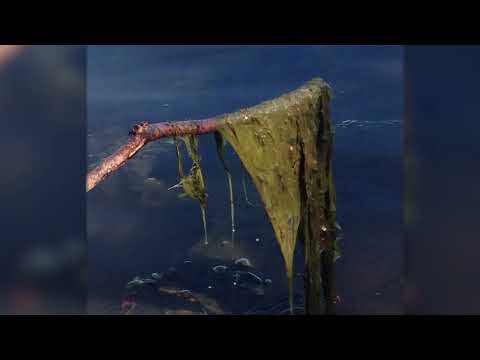 Know What Grows in Our Lake: How to Identify Cyanobacteria
